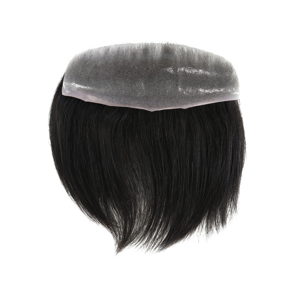 Men's Frontal Hairpiece Covering Receding Hairline – ReHair System