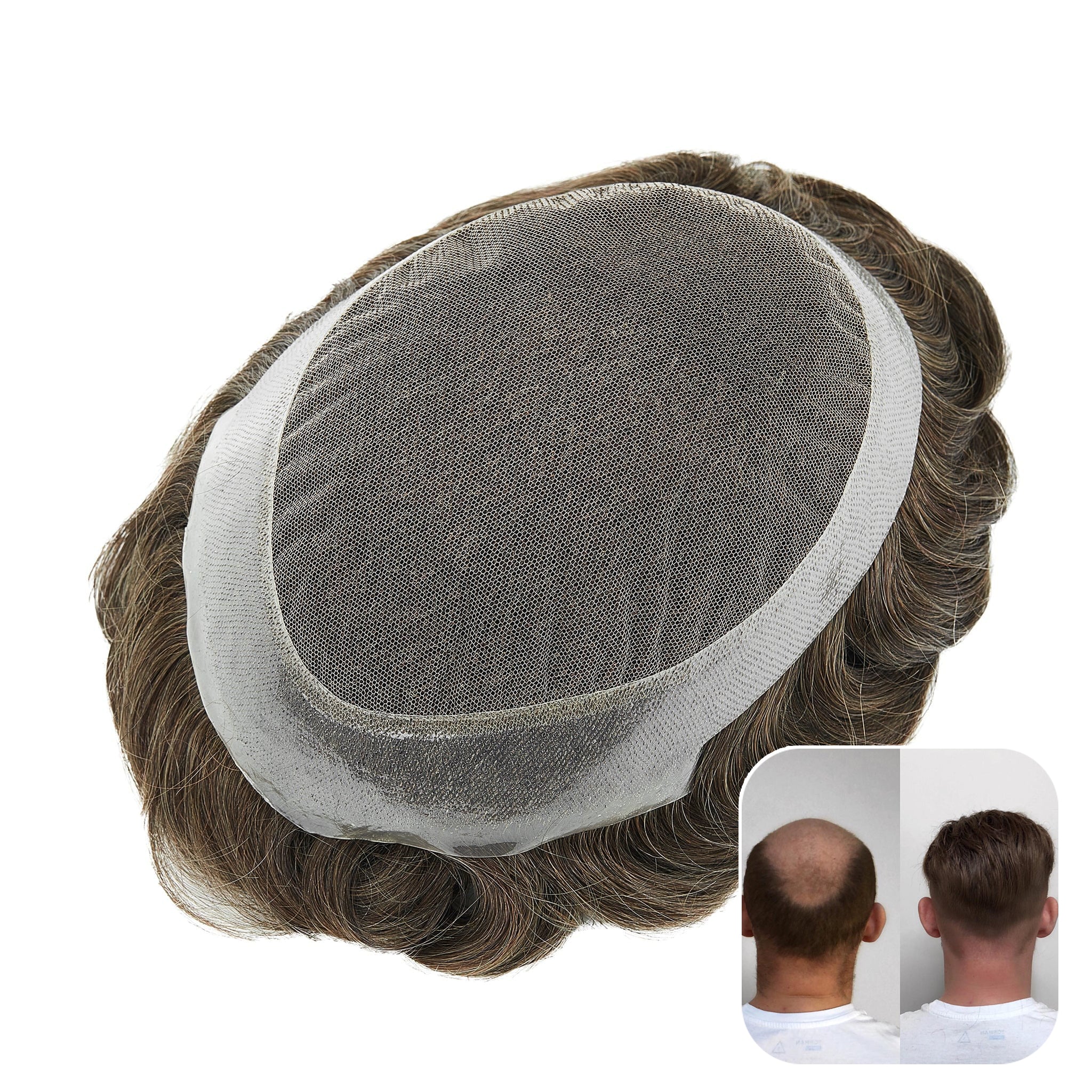 Lace Hair Systems - Breathable - ReHair System