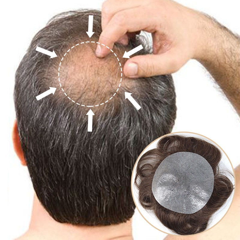 Crown Hair Patch | Covering Balding or Thinning Crown – ReHair System